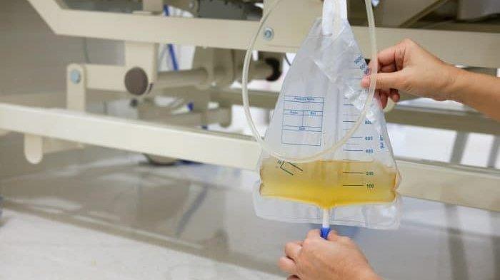 Apa itu kateter? Kenali Kegunaan, Jenis, dan Prosedur Pemasangan ...