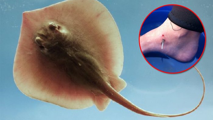 HEBOH Menteri Agama Disengat Ikan Pari, Begini Fakta Bahaya Racun dan ...