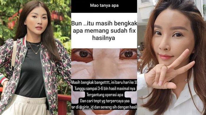 Wajah Baru Sawendah Usai Oplas Terkuak, Paras Istri Ruben Onsu Bikin Pangling,Netizen:Kok Jadi ...