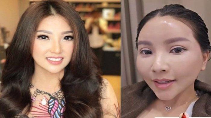 Demi Wajah Mulus dan Awet Muda, Segini Biaya Oplas Sarwendah di Korea Selatan - Pos-kupang.com