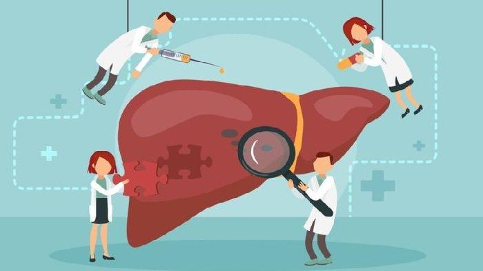 Gejala Penyakit Liver Akibat Faktor Keturunan, Kenali Jenis-jenisnya ...