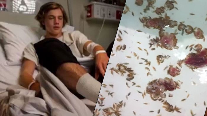 Anda Biasa Berenang di Laut? Ini 4 Cara Mudah Agar Kaki Tak Berdarah ...