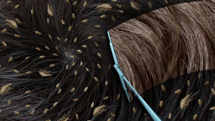 Termasuk Dalam Jenis Seranga dan Pertanda Kurang Bersih, Wajib Tahu 10 ...