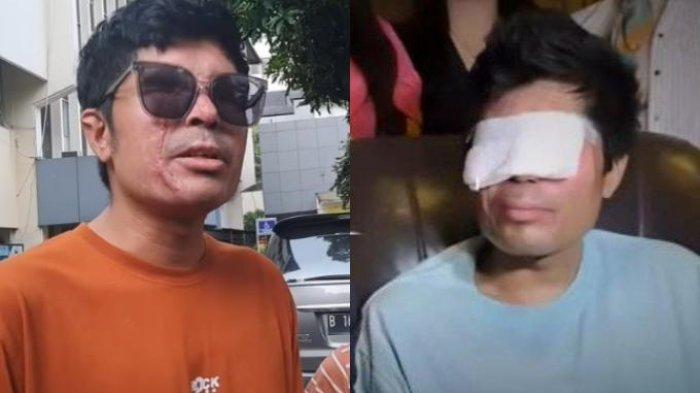 Curhatan Agus Sedih Kehilangan Uang Donasi, Ngaku Hanya Diberi Janji ...