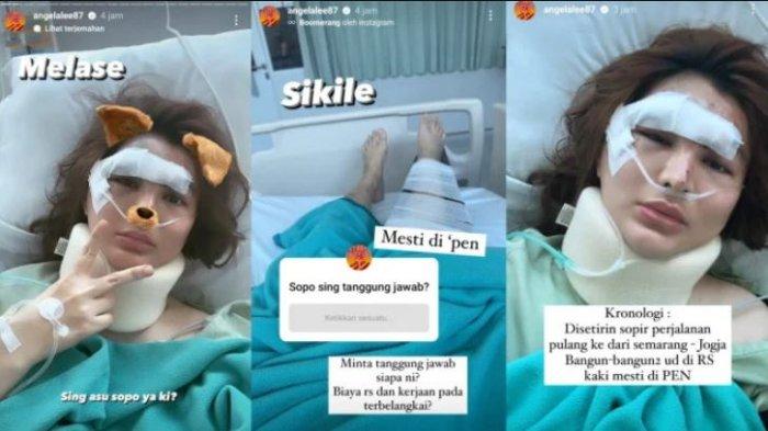 Angel Lee Kecelakaan Mobil, Ponsel Mewahnya Dicuri - Tribunlampung.co.id