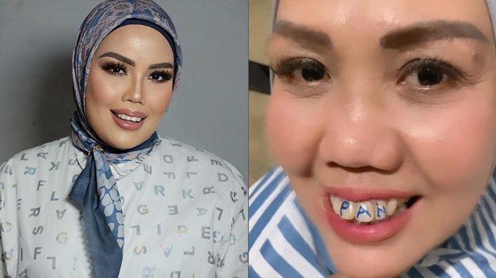 Elly Sugigi Ungkap Rencana Perbaiki Tampilan Gigi hingga Operasi ...