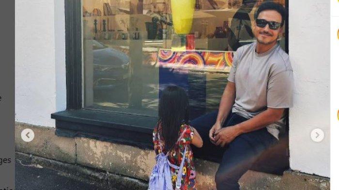 Anak Putri Hamish Daud Trauma dengan Dokter Gigi - Tribunlampung.co.id