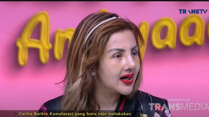 Barbie Kumalasari Oplas Lagi gegara Banyak yang Komplain Hidungnya Besar - Tribunlampung.co.id