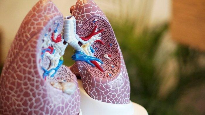 Tjahjo Kumolo Meninggal Dunia Sakit Paru-paru, Kenali 7 Jenis Infeksi ...