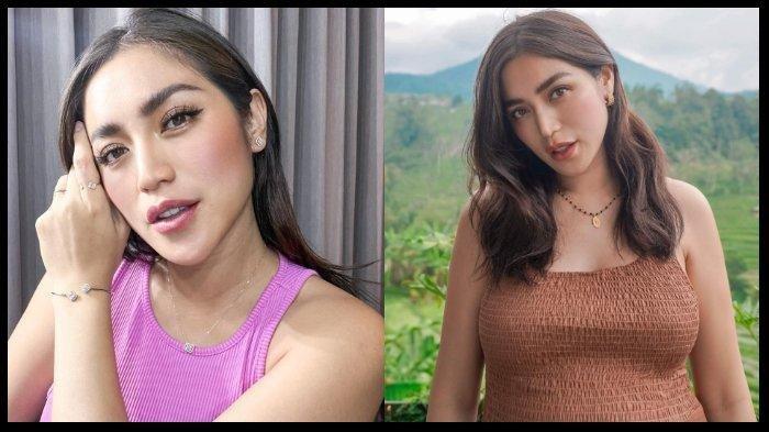 Jessica Iskandar Operasi Plastik Bagian Hidungnya di Korea Selatan ...