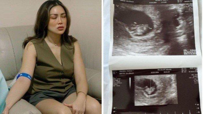 Jessica Iskandar Ungkap Kondisi Janin yang Dikandungnya Usai USG ...