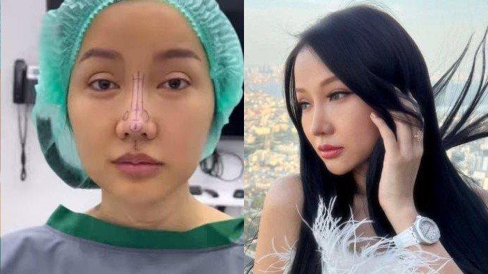 Doa Lucinta Luna Ketika Menjalani Operasi Plastik - Tribunlampung.co.id