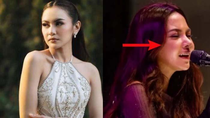 Mahalini Ungkap Kondisi Mentalnya Usai Ramai Dihujat Gegara Operasi ...