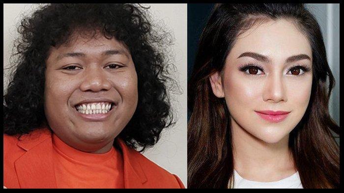 Celine Evangelista Direstui Menikah dengan Marshel Widianto, Keluarga Ingatkan 1 Syarat ...
