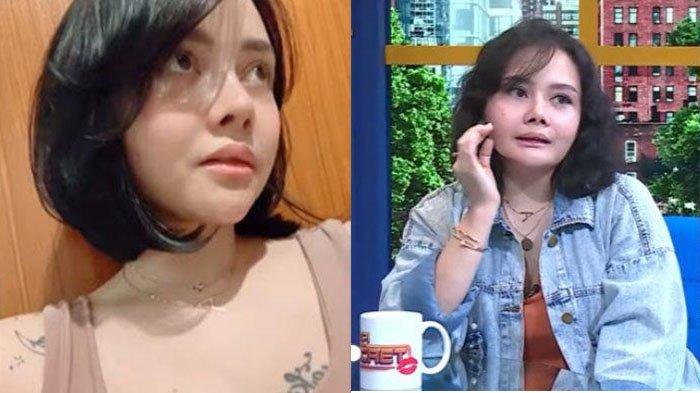 Mawar AFI Kini Berubah Drastis setelah Jalani Operasi Rahang, Wajahnya ...