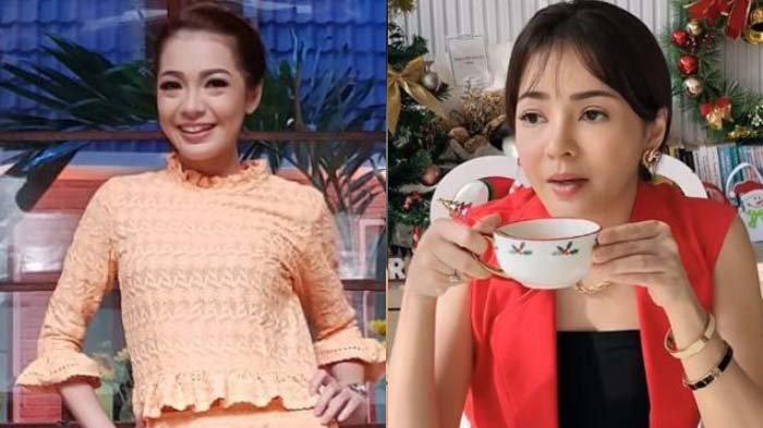 Perubahan Wajah Maya Septha Usai Oplas Bikin Pangling - Tribunlampung.co.id