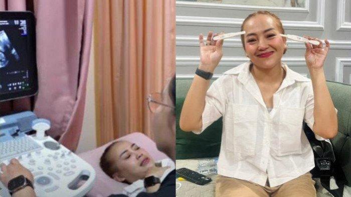 Biaya Pemeriksaan Kehamilan dan Persalinan Mpok Alpa Ditanggung Raffi Ahmad - Tribunlampung.co.id