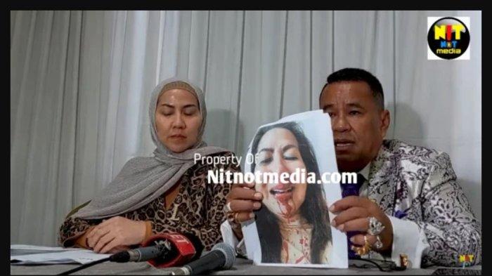 Reaksi Hotman Paris Saat Venna Melinda Difitnah Pukuli Diri Sendiri hingga Berdarah - Halaman ...