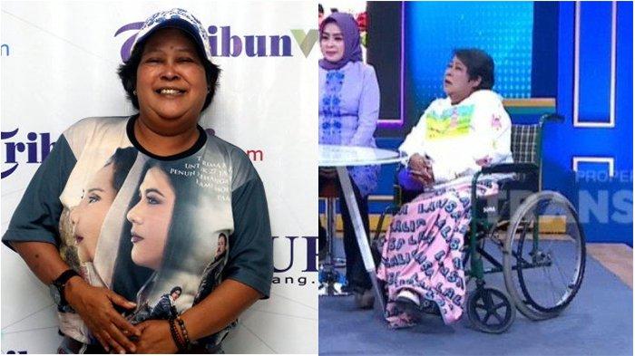 Baru 2 Hari Pakai, Suti Karno Lepas Pasang Kaki Palsunya - Halaman all - Tribunlampung.co.id