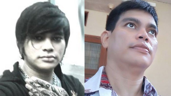 Dulu Vokalis Band Terkenal, Kini Kondisinya Memprihatinkan. Stroke dan Digugat Cerai Istri ...