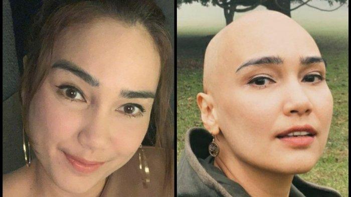 Penampilan Terkini Artis Feby Febiola yang Sempat Idap Kista Ovarium ...