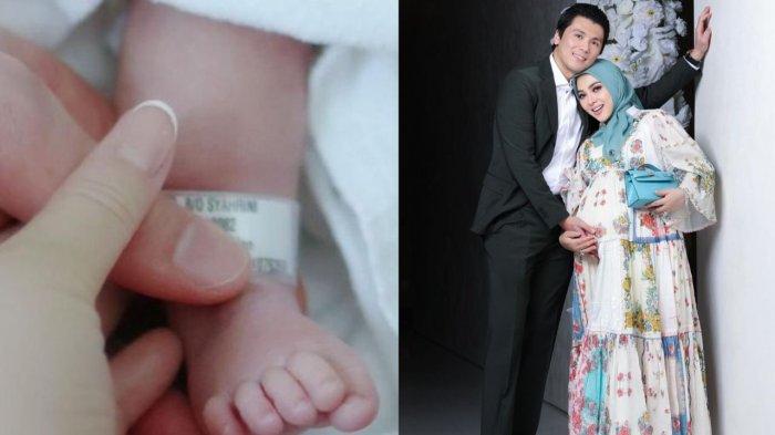 Anak Syahrini Cantik dan Bermata Sipit, Kakinya Jadi Sorotan - Tribunlampung.co.id