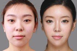 Mengenal Teknik Korean Nose, Bisa Bikin Hidung Mancung - Tribunlampung ...