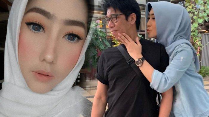 Cantiknya Istri Kedua Parto Patrio, Lebih Muda 18 Tahun - Tribunlampung.co.id