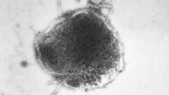 Mengenal Penyakit Campak, Penyebab dan Cara Pencegahannya ...