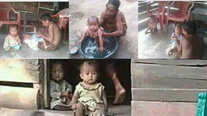 Viral Kisah Pilu Si Kembar Rana dan Rani, Begini Fakta-Fakta di ...