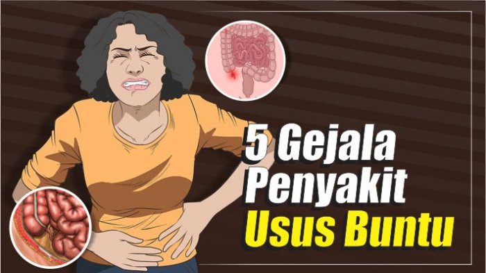 Gejala Penderita Usus Buntu - Tribunlampung.co.id