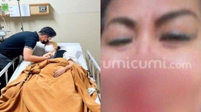 Kronologi Dugaan KDRT Ferry Irawan, Hidung Venna Melinda Ditekan Pakai Kepala Suami Hingga ...