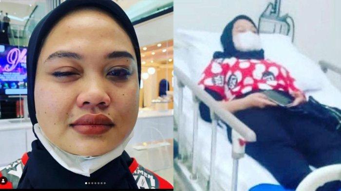 Viral Driver Ojol Diduga Aniaya Karyawan Wanita RamenYa Sampai Mata ...