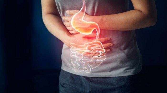 Cara Mengatasi hingga Makanan yang Harus Dihindari Penderita GERD ...