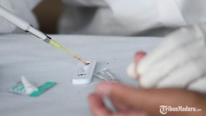 Layanan Rapid Test Gratis untuk Warga Madiun yang Hendak ke Luar Kota ...