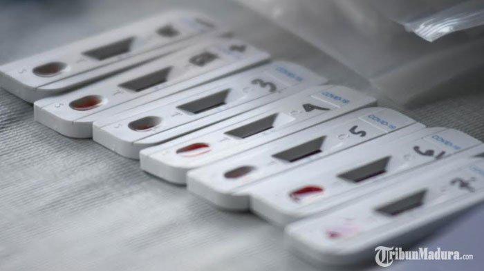 Jadwal Layanan Rapid Test Peserta UTBK SBMPTN 2020 Gelombang 2 di ...