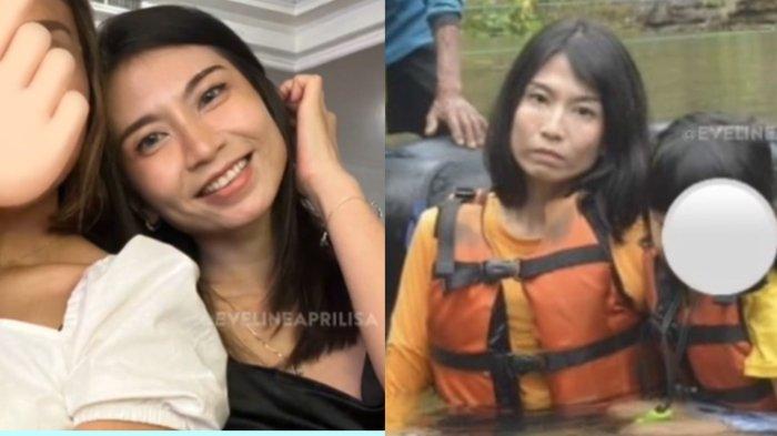 ‘Sekaku Gagang Sapu’, Cerita Wanita Gagal Suntik Botox, Cuma Bisa ...