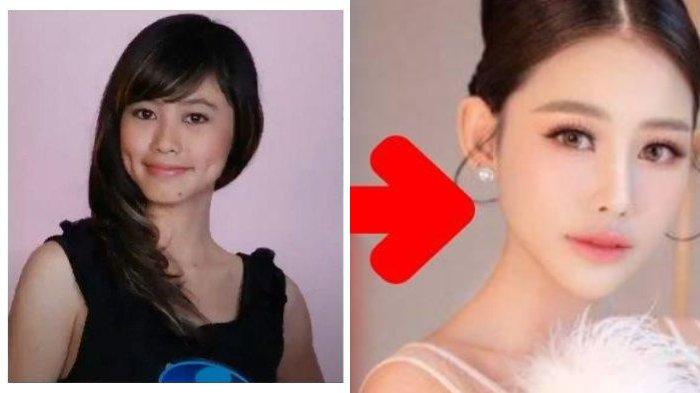 Ingat Dyna Fransisca Finalis Indonesian Idol Nekat Operasi Plastik ...