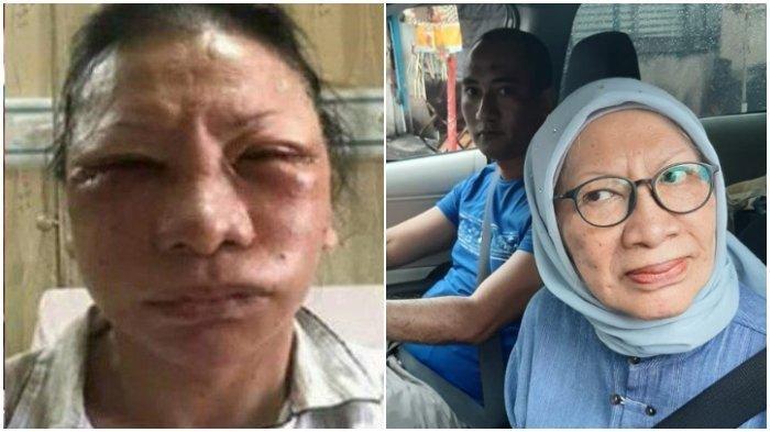 Ingat Ratna Sarumpaet? Dulu Dipenjara Gegara Berita Bohong, Kini Dilapor Cucu ke Polisi ...