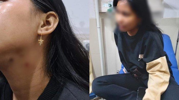 Teror Begal Kembali Terjadi di Makassar, Siswi SMA Kena Busur di Leher ...