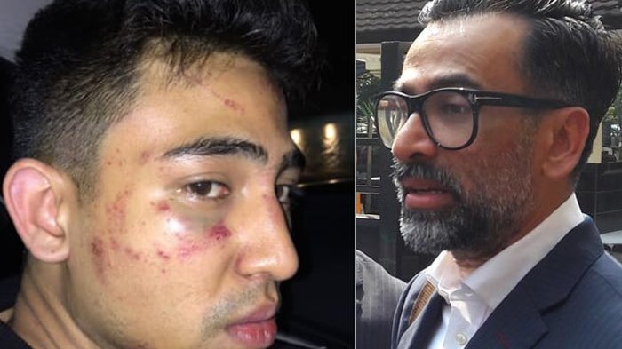 Putra Jeremy Thomas Ditetapkan Tersangka, Begini Nasib Pendidikannya di ...