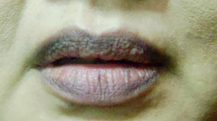Tak Perlu ke Salon, Berikut Cara Putihkan Bibir Perokok Pakai Buah ...
