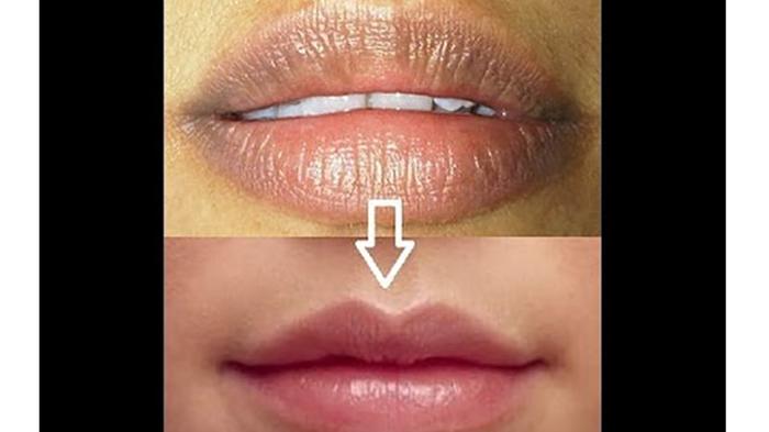 Buat Perokok, Hilangkan Bibir Hitammu Pakai Susu atau Kunyit, Ini ...