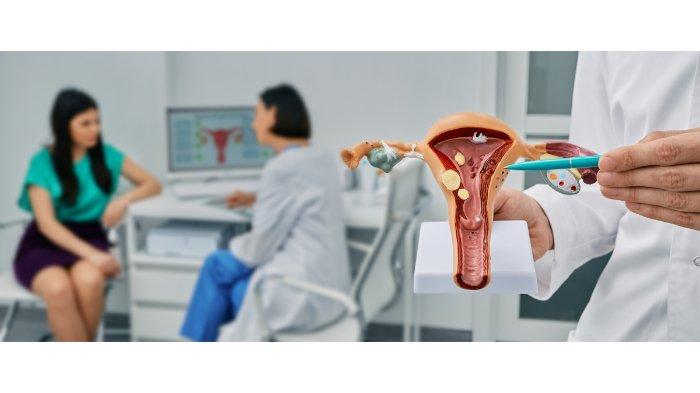 Haid Tidak Normal Bisa Jadi Tanda Miom dan Kista Kandungan - Tribun ...