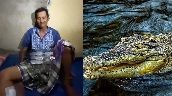 Kaki Tergigit Diseret ke Lubang Namun Kakek 60 Tahun di Makassar ...