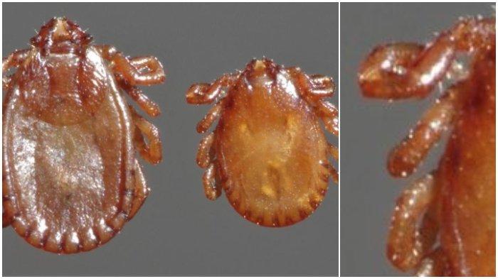 MENGENAL Virus Tick Borne, Baru Muncul di China Disebabkan Kutu ...