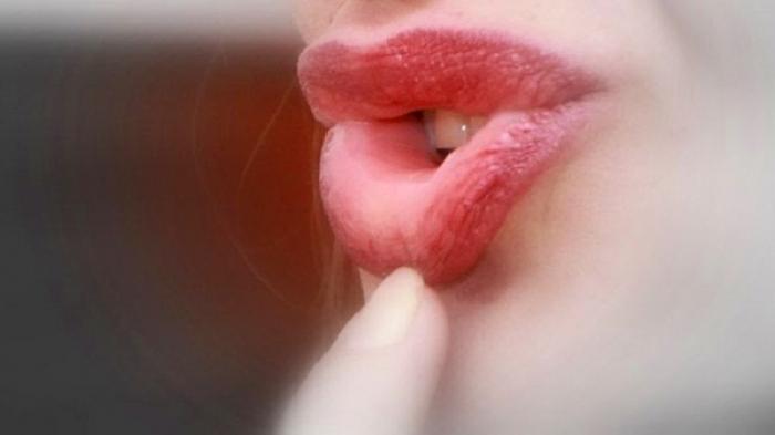 Tanpa Lipstik, Ini 10 Bahan yang Bisa Bikin Bibirmu Tetap Merah Merona, Gampang Ditemukan ...