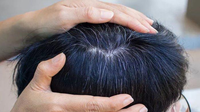 4 Bahan Alami yang Bisa Digunakan Atasi Rambut Uba - Tribun-timur.com