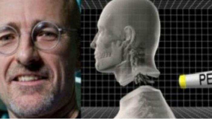 Pria Ini Bersedia Operasi Cangkok Kepala - Tribun-timur.com