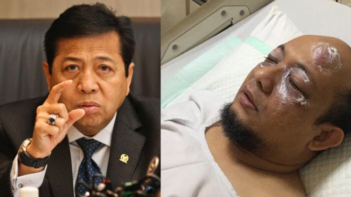 Novel Baswedan Disiram Air Keras di Wajahnya, Setya Novanto Tiba-tiba ...